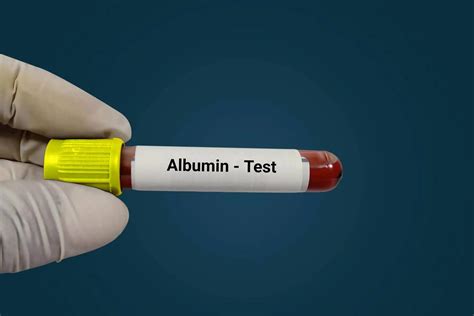 Albumin Test In Reading Book With The Forbury Clinic