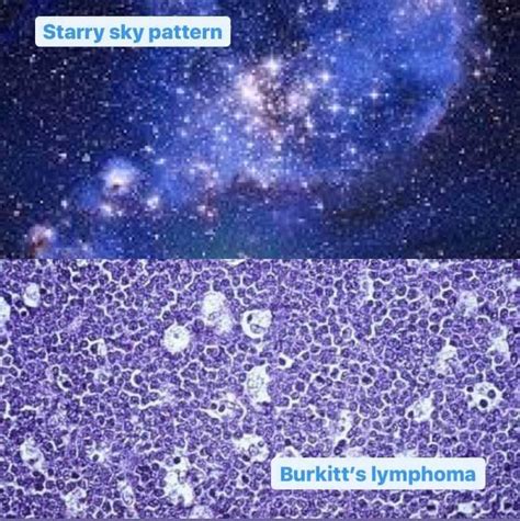 Mnemonics Controversy Over For Me Also For You Mnemonic