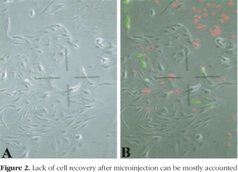 Figure 2 From Nuclear Envelope Irregularity Is Induced By Ret Ptc During Interphase Semantic