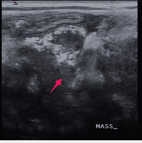 Grayscale Us Of The Abdomen Using A Superficial Probe 7 5 Hs Download Scientific Diagram