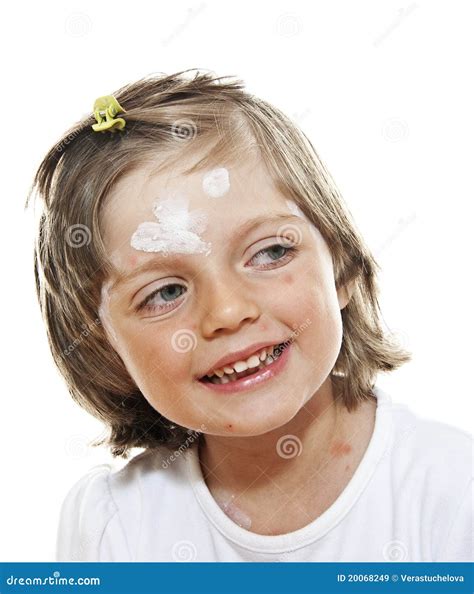 Smallpox Stock Image 51782149