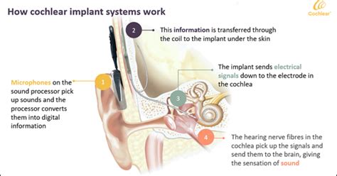 cochlear asic fpga development at cochlear technology center