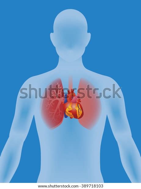 28 Copd Heart Failure Stock Vectors And Vector Art Shutterstock
