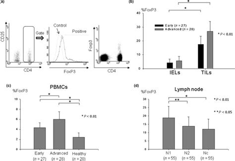 Distribution Of Th17 Cells And Foxp3 Regulatory T Cells In Tumor