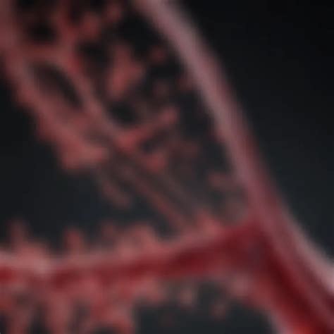 Comprehensive Study Of Igg Lambda Myeloma