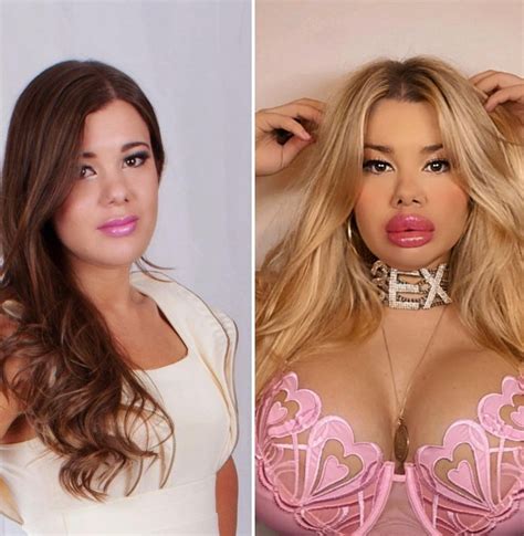 Bimbo Who Spent £15k On Barbie Look Shares Pics Taken Before Extreme