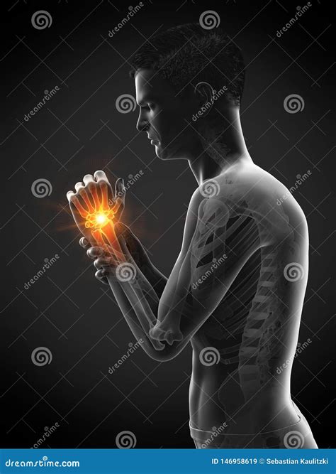 Mu Eca Dolorosa Stock De Ilustraci N Ilustraci N De Inflamado