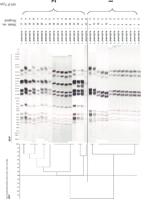 Dendrogram Of Legionella Pneumophila Ser 1 Strains Typed By Aflp