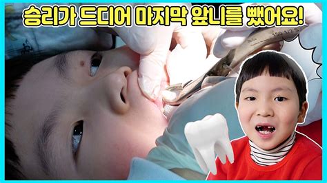 승리가 드디어 마지막 앞니를 뺐어요 먼저 치과에 가자는 승리 ㅋㅋㅋ 사랑아놀자 네이버 Tv