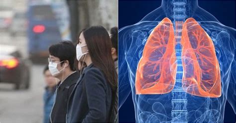 미세먼지 코 흡입이틀 뒤 폐에 가량 쌓여 배출엔 일주일 디스패치 뉴스는 팩트다