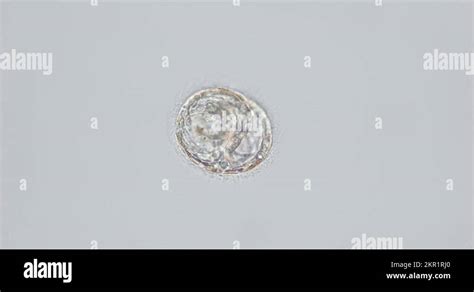 Worm Larva Ophelia Limacina At Trochophora Stage Under Microscope