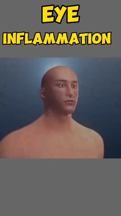 Eye Inflammation Demystified My Healthy Fitness Tips®