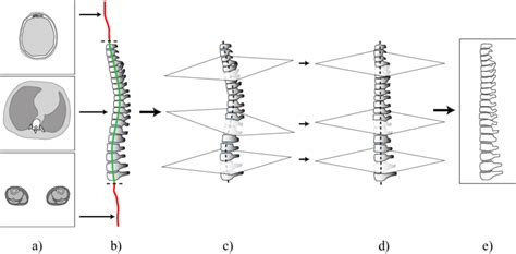 The Spine Straightening Pipeline A Three Axial Slices From Different