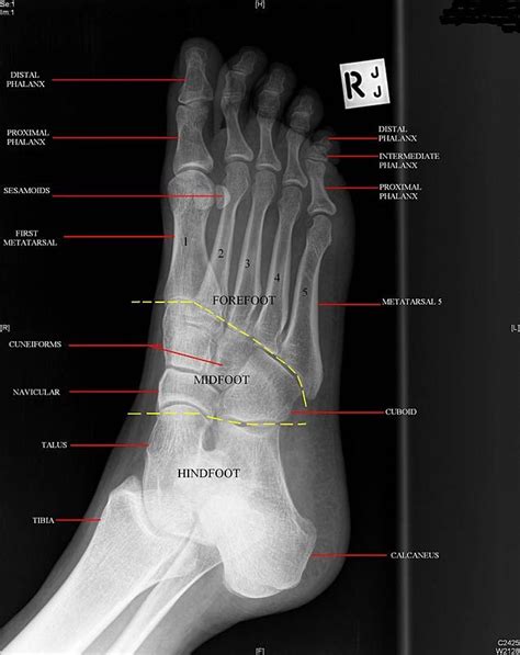 Foot Oblique Uk Medical Anatomy Radiology