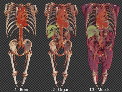 Multi Layer Gaussian Splatting For Immersive Anatomy Visualization