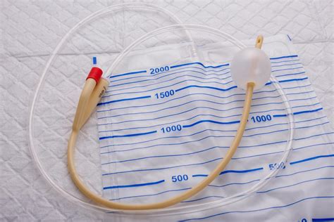 Urinary Catheter History Modern Urinary Catheterization Ukobbq