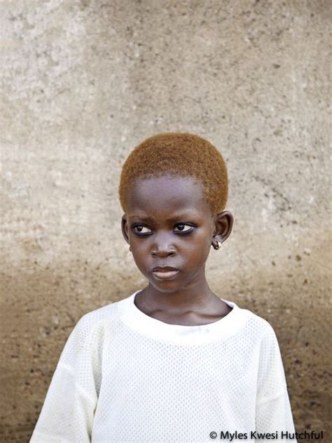African People With Red Hair