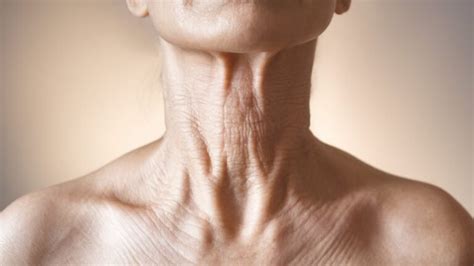 How To Get Rid Of Neck Lines 9 Ways Thebeautyfoodie