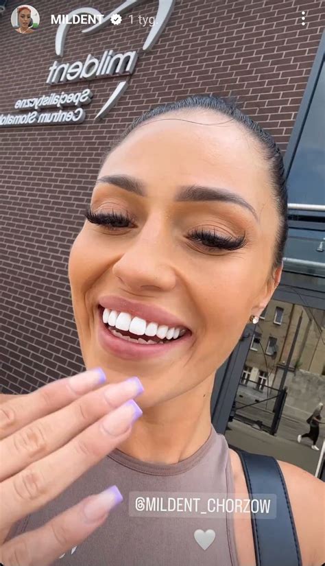 Beata Kurpas Z Love Island Zrobiła Sobie Nowe Zęby Fortepian Ibisza