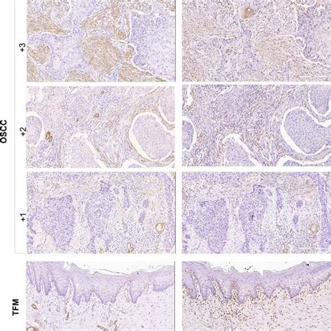 Main Networks Involved In Oscc Pathogenesis Shades Of Red Are