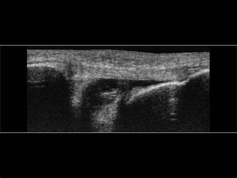 Musculoskeletal Joints And Tendons 66 Knee Case 6610 Bursa And