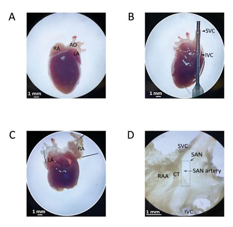 Sinoatrial Node Isolation From Mouse Model A Procedure To Harvest Sa