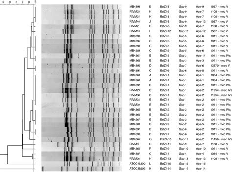 dendrogram and fingerprints for pfge using restriction enzyme bstzi