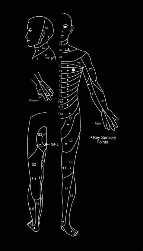Sci Classification Neuroresus