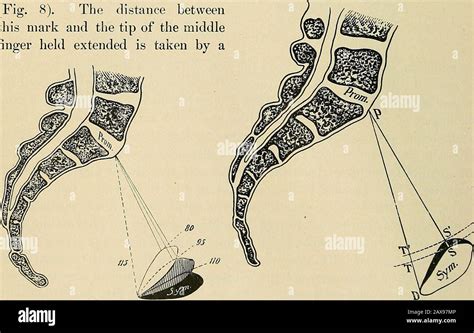 The American Text Book Of Obstetrics For Practitioners And Babes Fig Measuring The