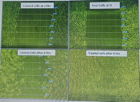 Crystal Biological Solutions On Linkedin In Vitro Scratch Assay