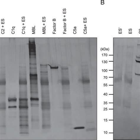Scheme Of The Similar Structure Of Complement Activation Molecules C1q