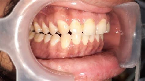 Group Function Occlusion Download Scientific Diagram