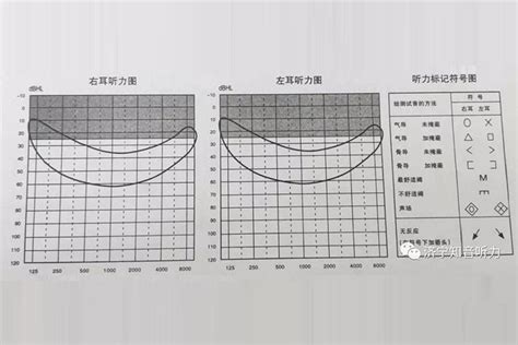 带你看懂听力图！ 济宁助听器专家【全国连锁 免费验配】