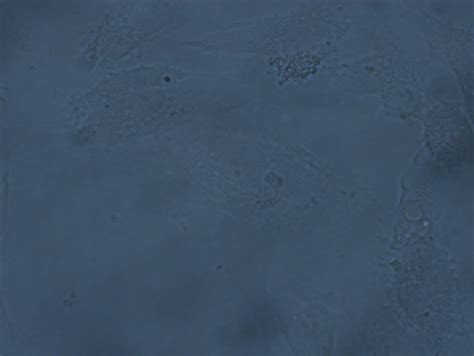 Contamination In Huvec Cells How To Identify Researchgate