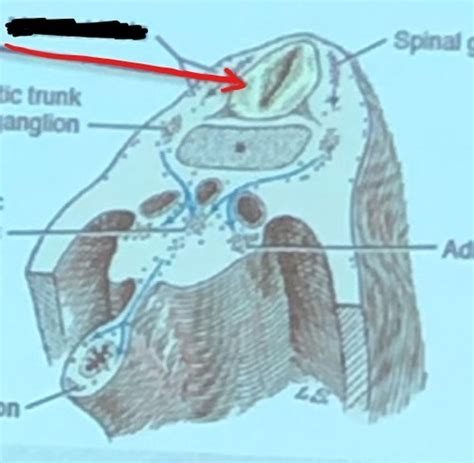 Exam 2 Clicker Questions Flashcards Quizlet