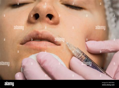 Contour Plastic A Cosmetologist Injects A Botulinum Toxin To Tighten And Smooth Out Wrinkles On