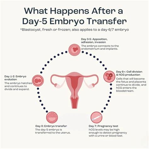 Post Ivf Embryo Transfer Symptoms Cbah