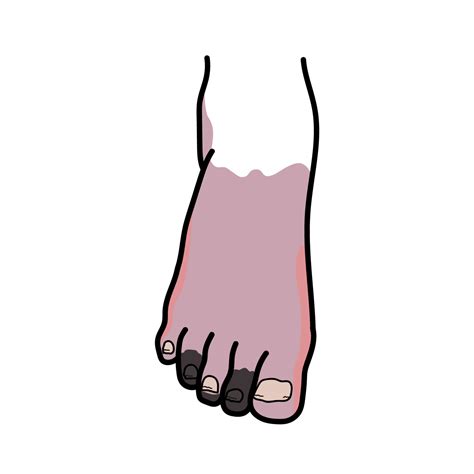 Approach To Upper Gastrointestinal Bleeding Causes Symptoms Melena