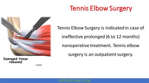 Olecranon Bursitis Aspiration And Injection Step By Step Guide