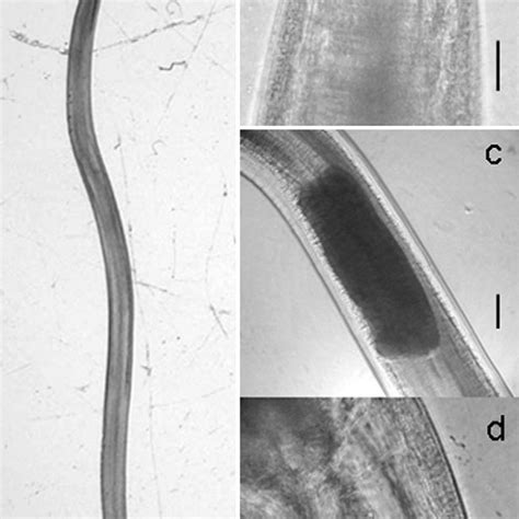 Morphology Of The Anterior Extremities Of Anisakis Simplex L3 Harvested