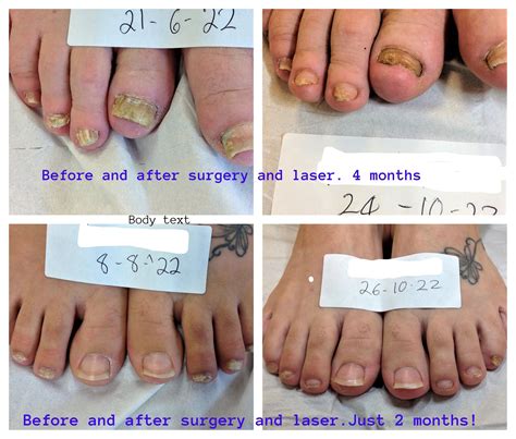White Nails Health Causes Science And Long Term Nail Care Explained