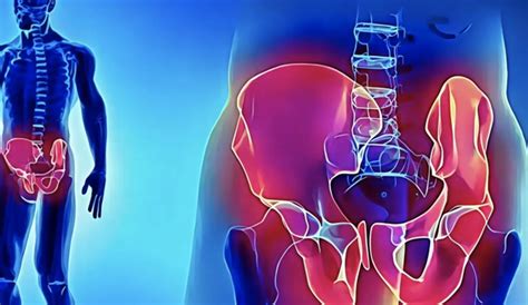 Sintomi Pubalgia E Diagnosi