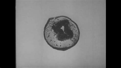 1930s Drawing Of Human Appendix Cross Section Of Appendix With Healthy Mucus Membrane Cross