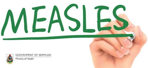 Ministry Of Health Confirms Suspected Measles Investigation