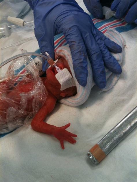 Me And My Crew Omgwere Having Sextuplets