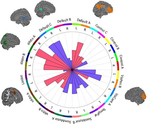 The Brain Activation Based Sexual Image Classifier Basic A Sensitive