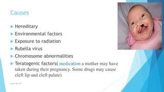 Clift Lip And Cleft Palate Pptx