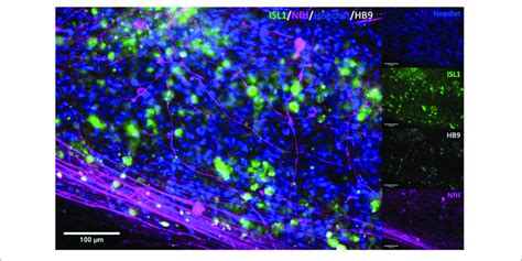 Immunocytochemical Stain For Motor Neuron Markers Staining For Motor