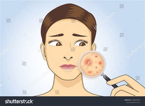 4,454 Treating Acne Images, Stock Photos & Vectors | Shutterstock