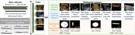 논문 리뷰 Mmsummary Multimodal Summary Generation For Fetal Ultrasound Video